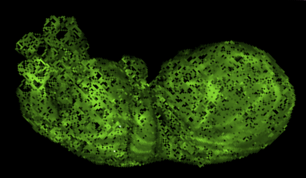 3D analysis of human embryos and fetuses using digitized datasets from ...
