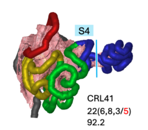 須藤さんの修士論文(その1）がNMR in BioMed. に受諾 – 京都大学 医学研究科 人間健康科学系専攻 病理学
